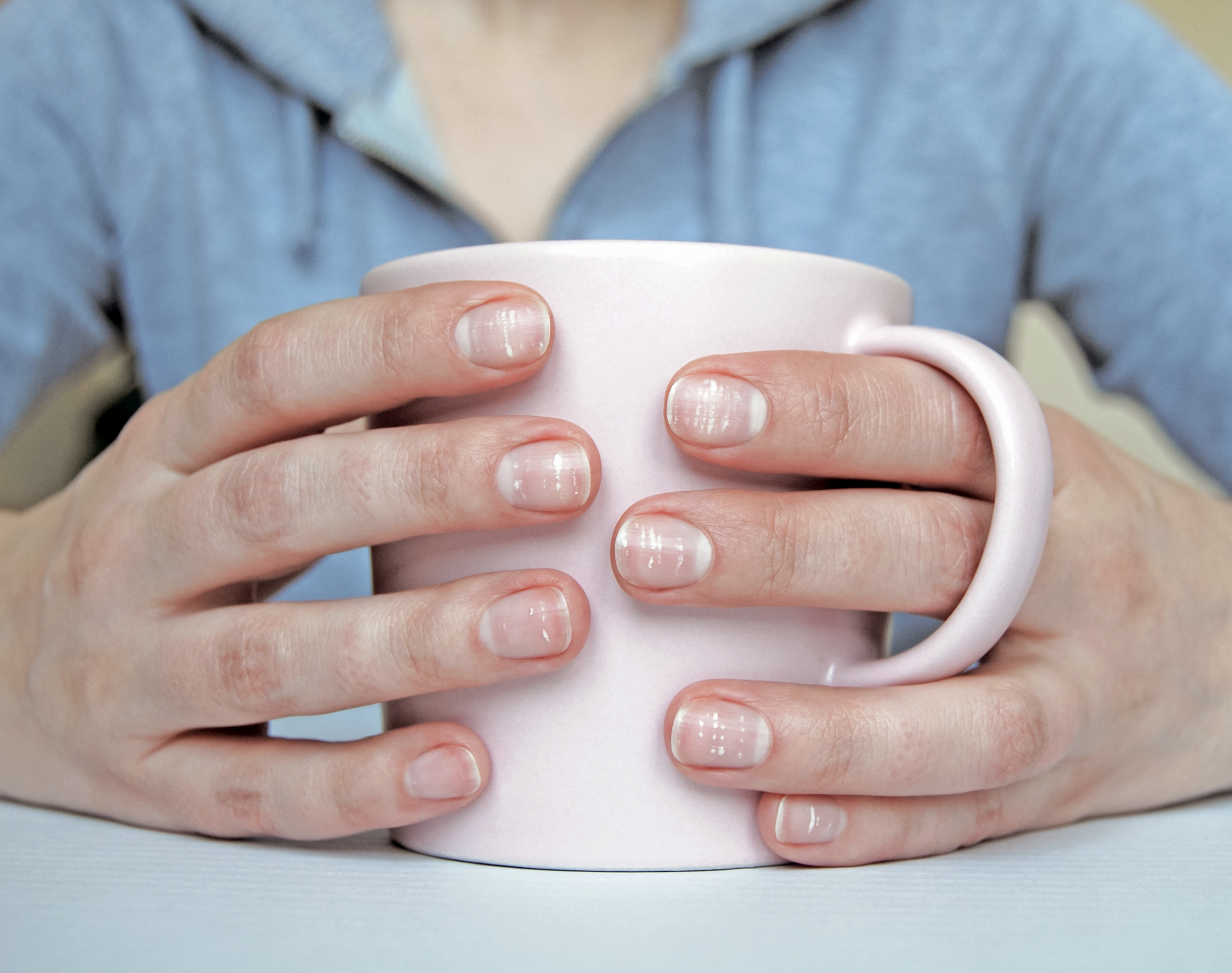 Nail Abnormalities - Part 1 (Leukonychia, Mee's Lines & Beau's Lines ...